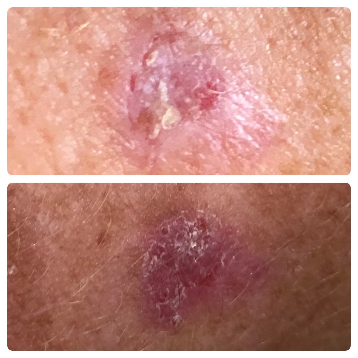 Skin Ulcer That Won’t Heal – Phancore Wellness